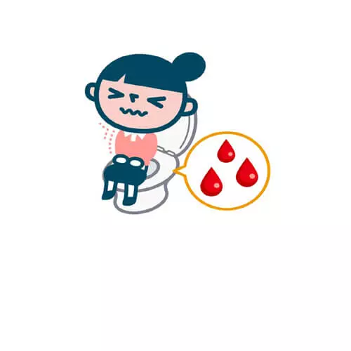 Bleeding Piles - Global Ayucare Herbal